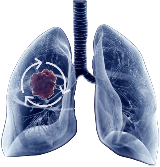 KRAS G12C | KRAZATI® (adagrasib) for NSCLC